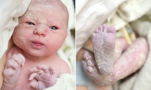 Vernix caseosa: H θαυματουργή ουσία των νεογνών - Mothersblog.gr